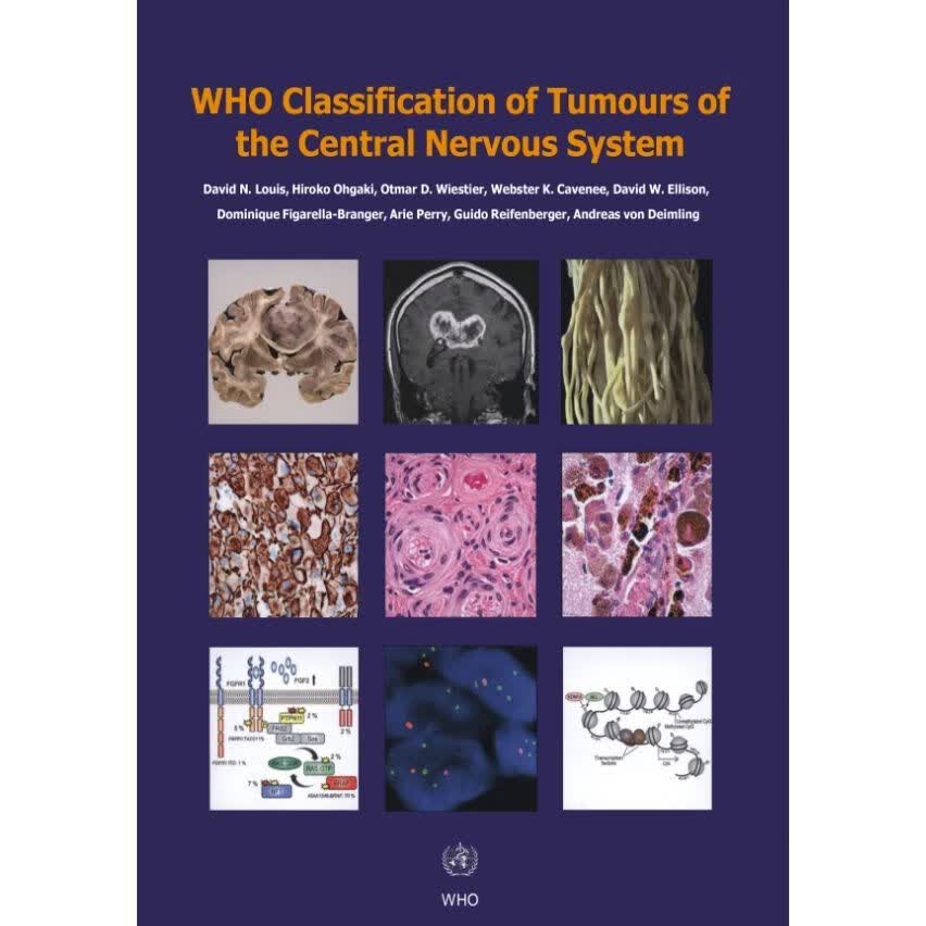 WHO Classification of Tumours of the Central Nervous System 通用