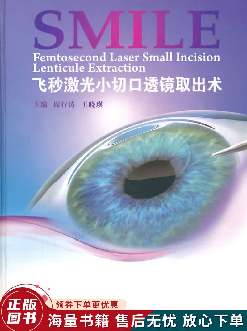 近视眼诊治新技术丛书：飞秒激光小切口透镜取出术SMILE