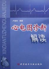 心电图诊断解读 卢喜烈