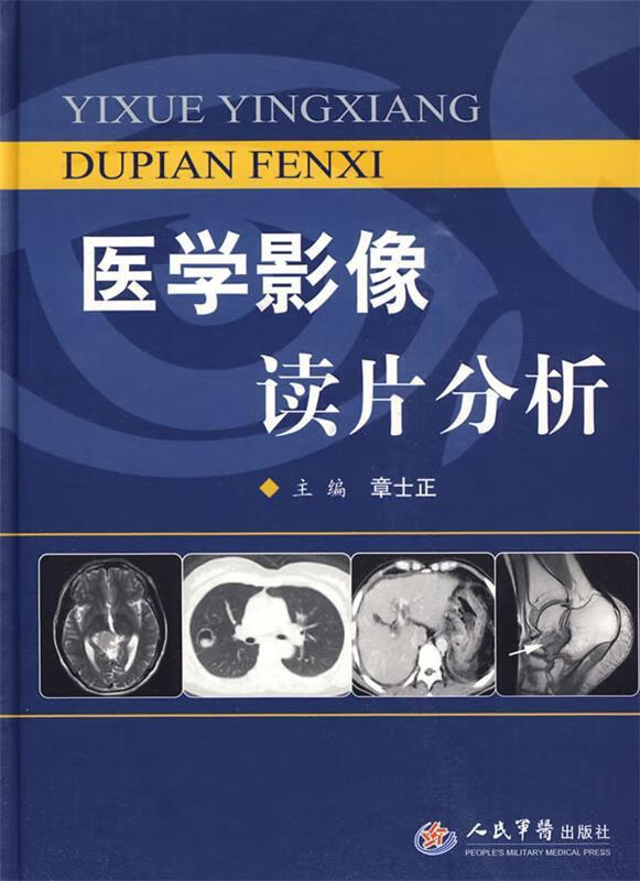 医学影像读片分析 章士正主编【书】