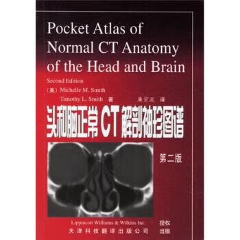 头和脑正常CT解剖袖珍图谱 天津科技翻译出版公司