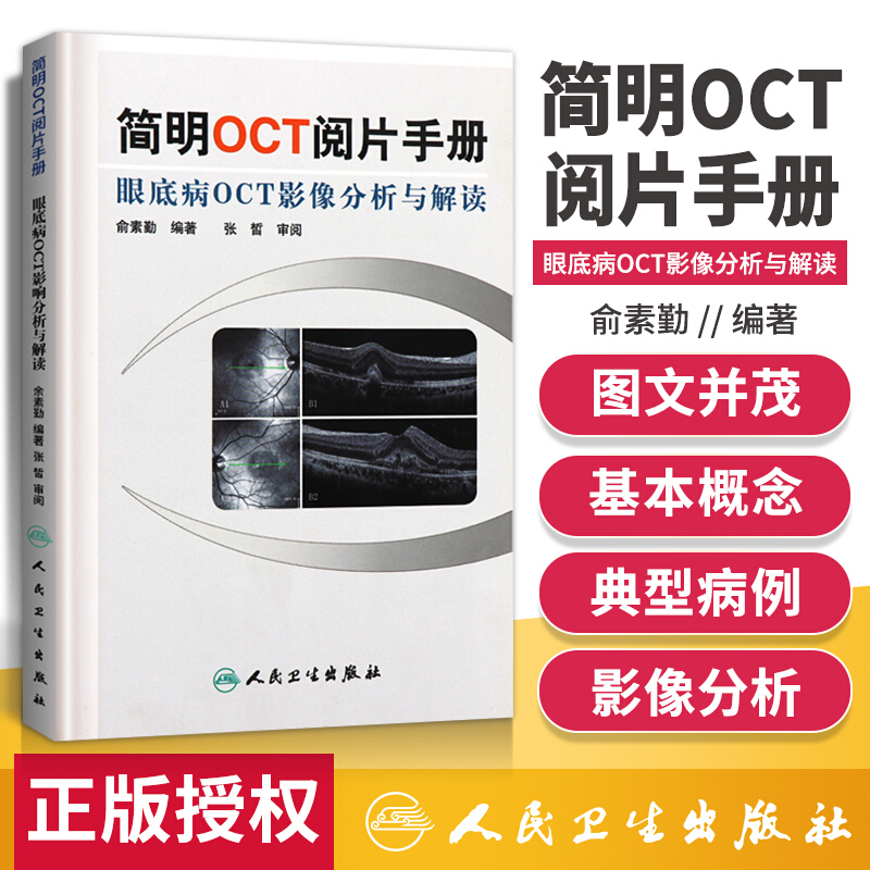 保证 简明OCT阅片手册 眼底病OCT影像分析与解读 俞素勤 OTC基本原理与技术 基础阅片影像眼科学视光技术应用 人民卫生出版社