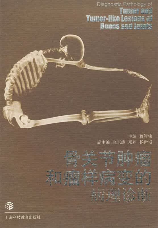 骨关节肿瘤和瘤样病变的病理诊断 蒋智铭主编