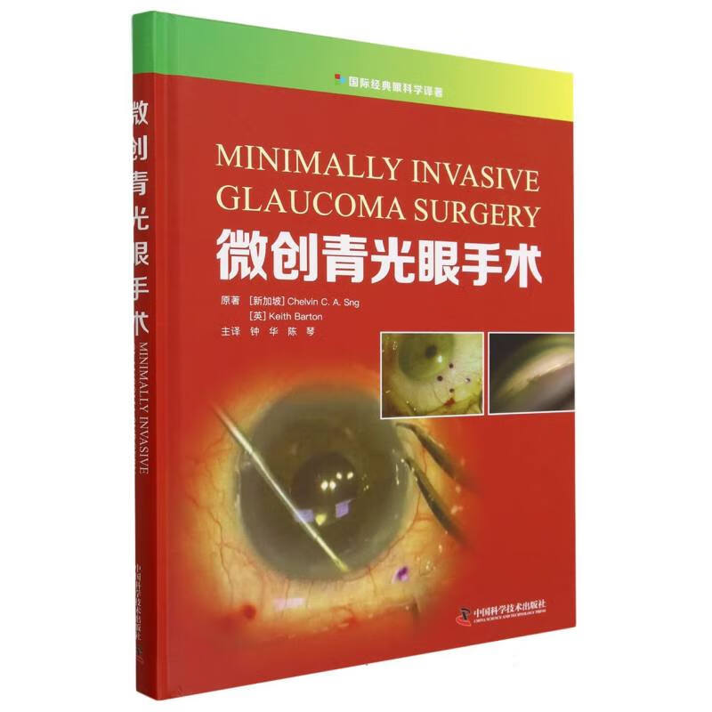微创青光眼手术