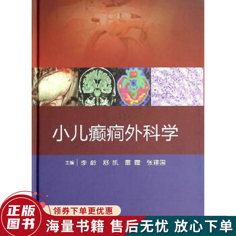 小儿癫痫外科学