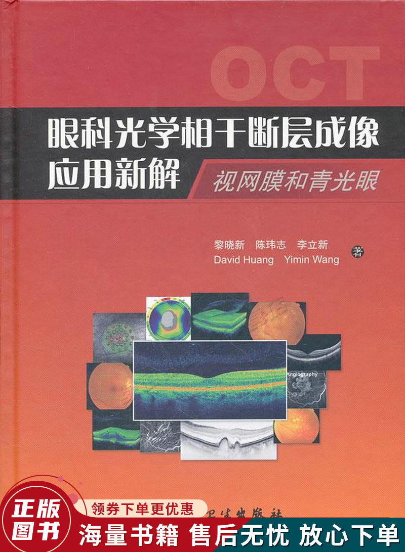 眼科光学相干断层成像应用新解：视网膜和青光眼
