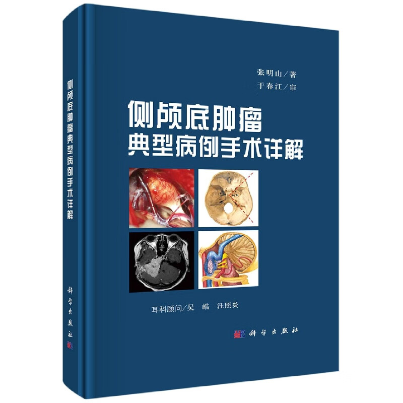 侧颅底肿瘤典型病例手术详解(精)