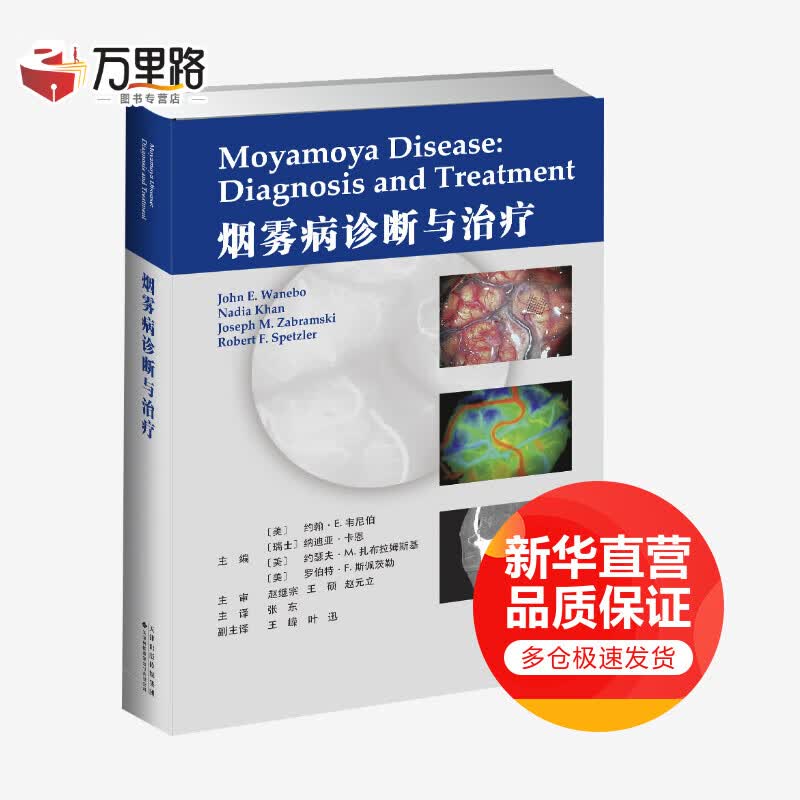 烟雾病诊断与治疗