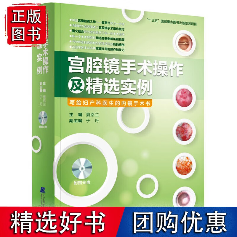 宫腔镜手术操作及精选实例
