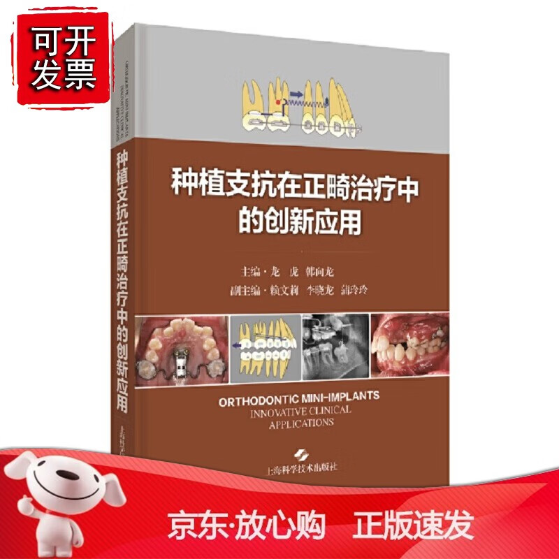种植支抗在正畸治疗中的创新应用