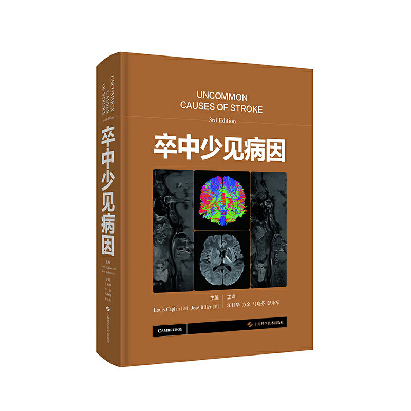 【现货】卒中少见病因