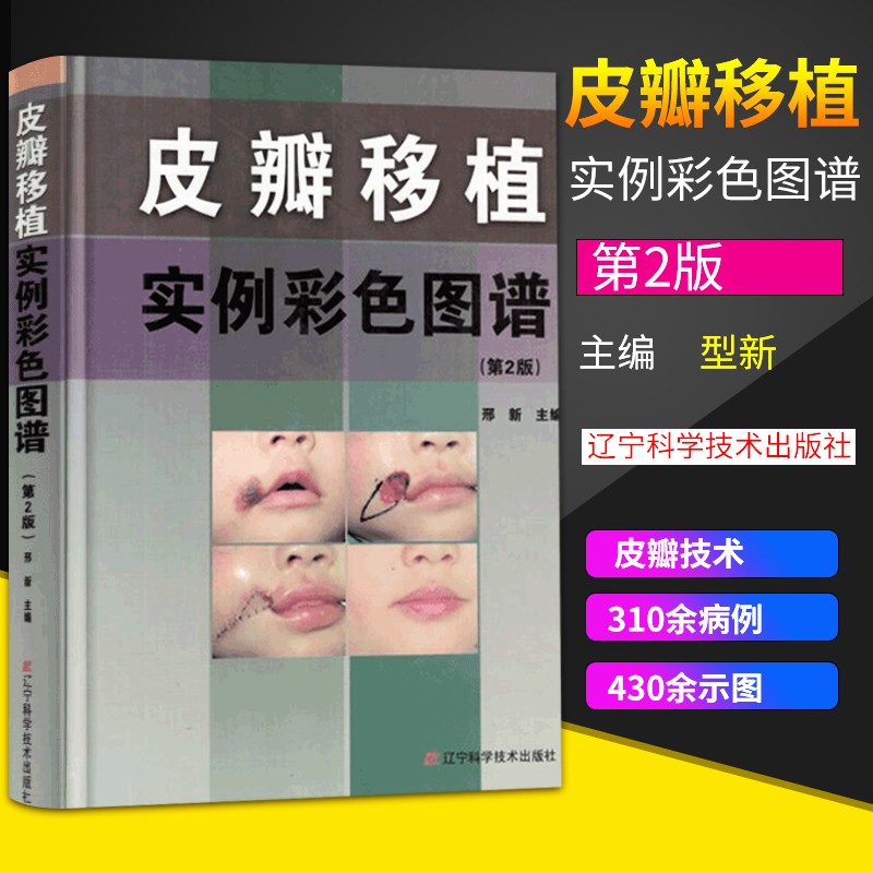 皮瓣移植实例彩色图谱 第2版 邢新 皮瓣移植临床手术图谱 美容外科医师临床参考书籍美容工具书 示意图 辽宁科学技术出版社