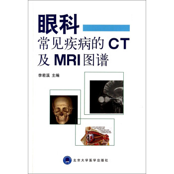 眼科常见疾病的CT及MRI图谱 李若溪 著