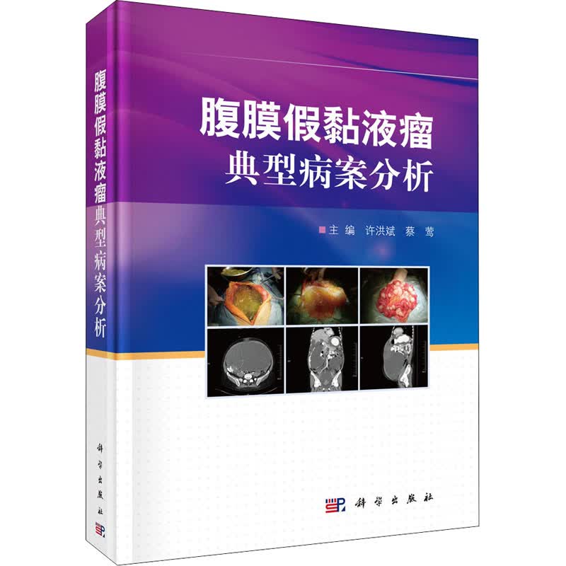 腹膜假黏液瘤典型病案分析 图书