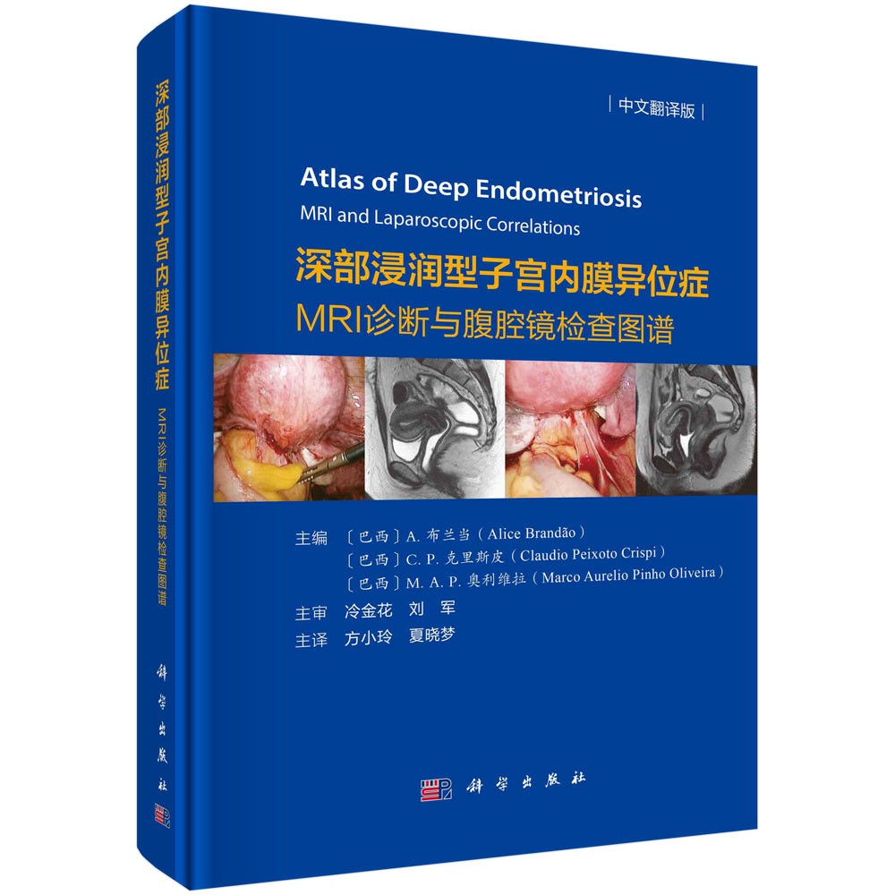 深部浸润型子宫内膜异位症：MRI诊断与腹腔镜检查图谱