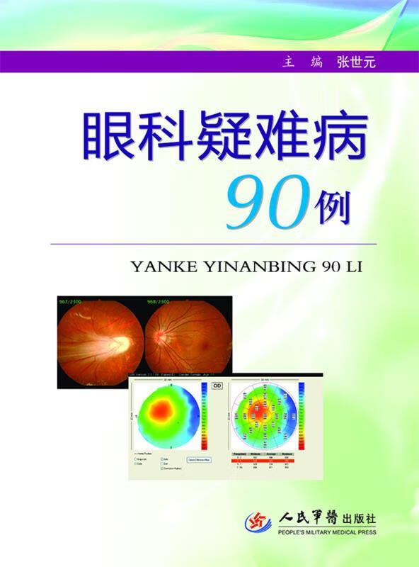 眼科疑难病90例