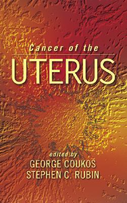 高被引Cancer of the Uterus