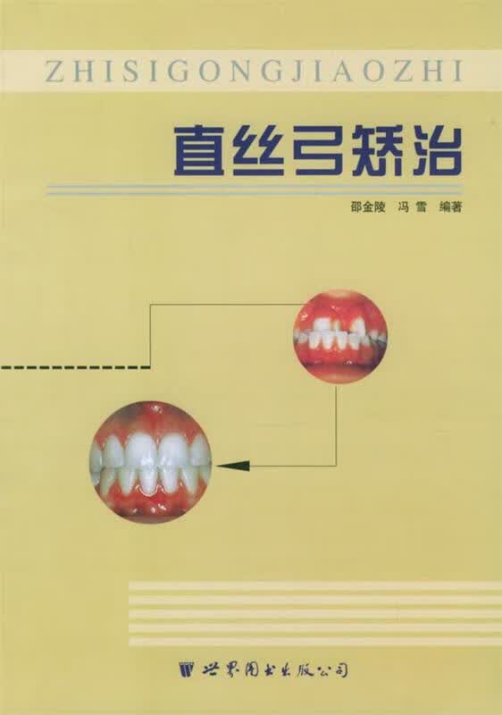 直丝弓矫治 邵金陵 著