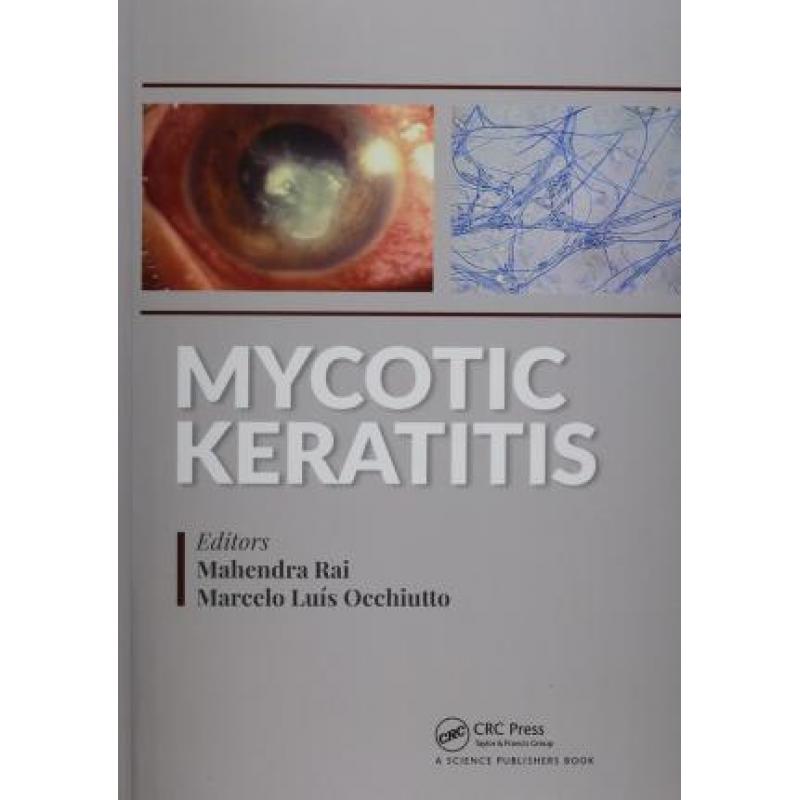现货 Mycotic Keratitis