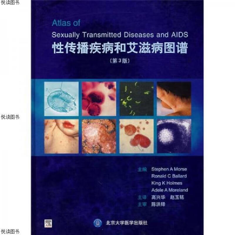 性传播疾病和*图谱(第3版)