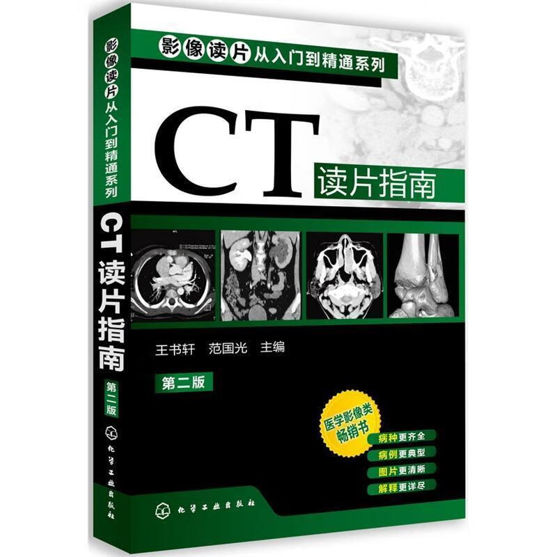 全新 CT读片指南 王书轩 编 化学工业出版社