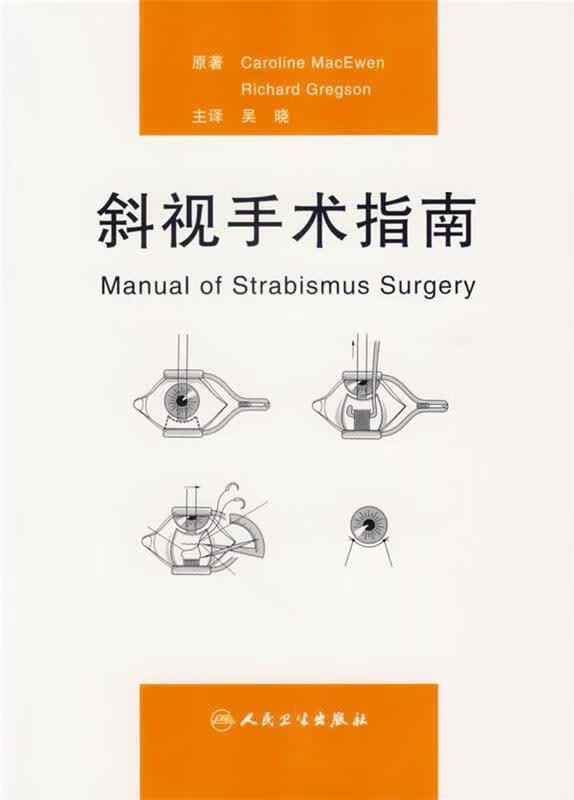 斜视手术指南