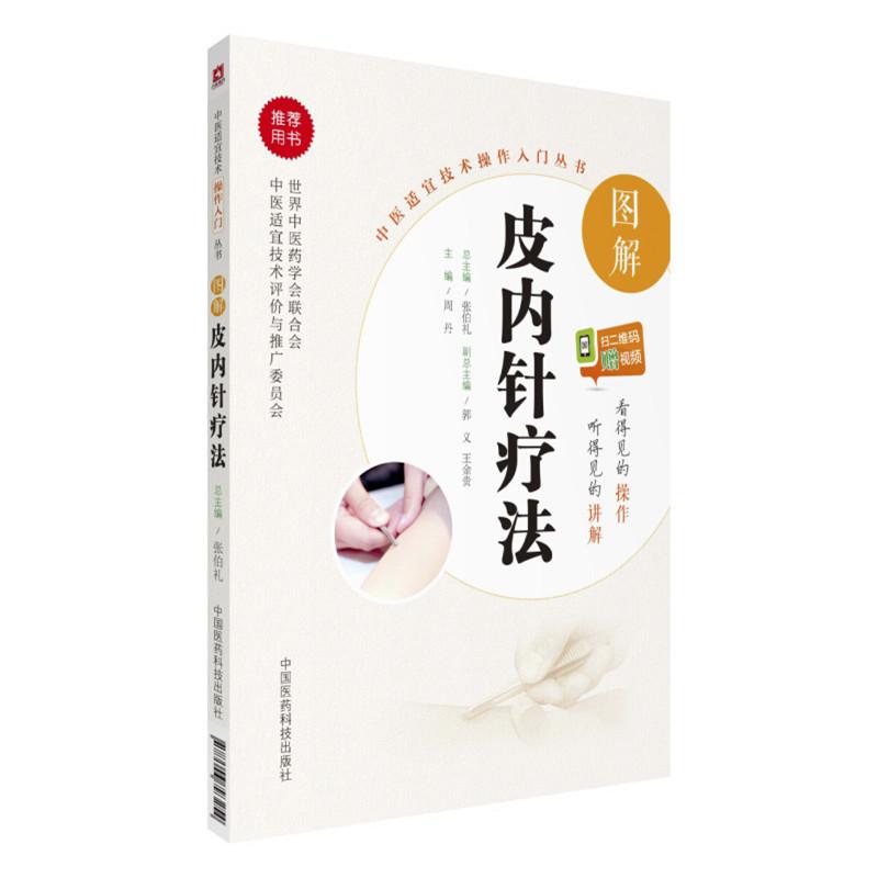 图解皮内针疗法