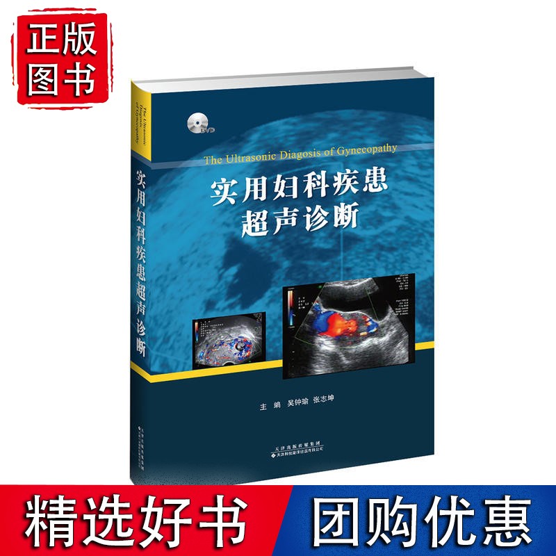 实用妇科疾患超声诊断
