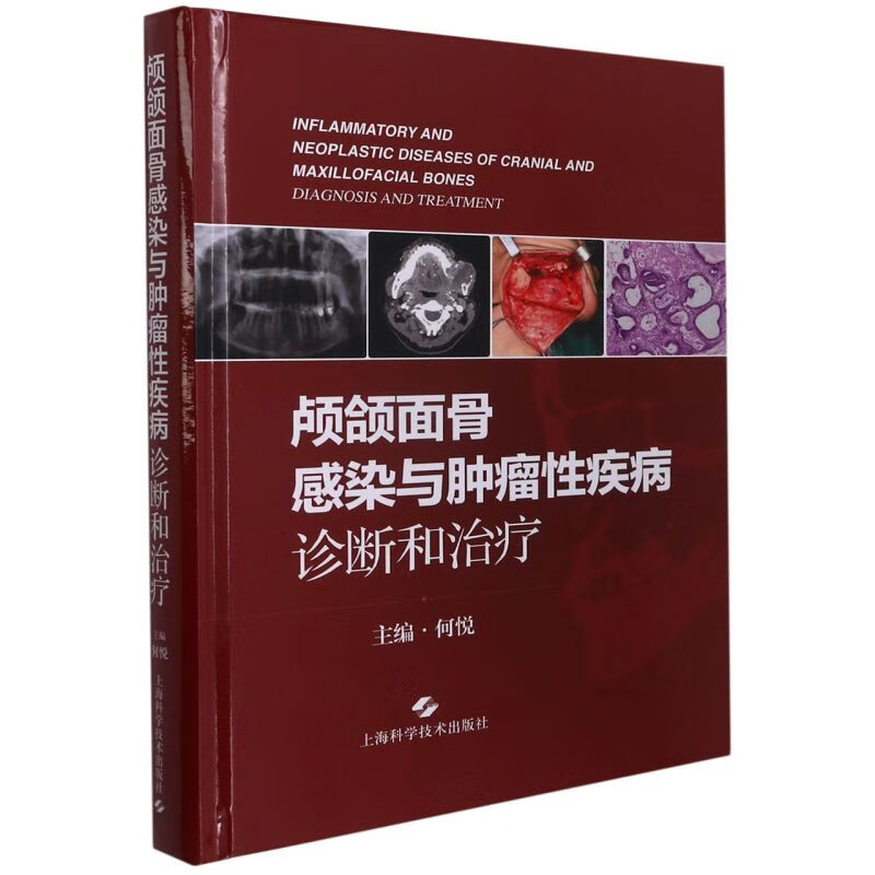 颅颌面骨感染与肿瘤性疾病诊断和治疗(精)