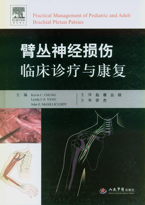 臂丛神经损伤临床诊疗与康复