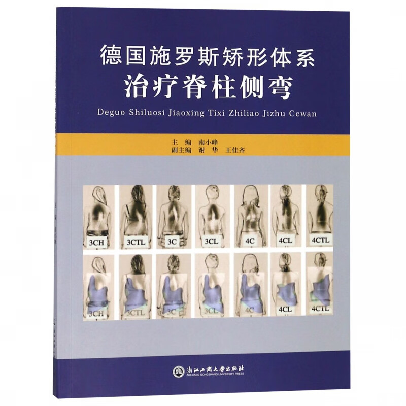 德国施罗斯矫形体系治疗脊柱侧弯