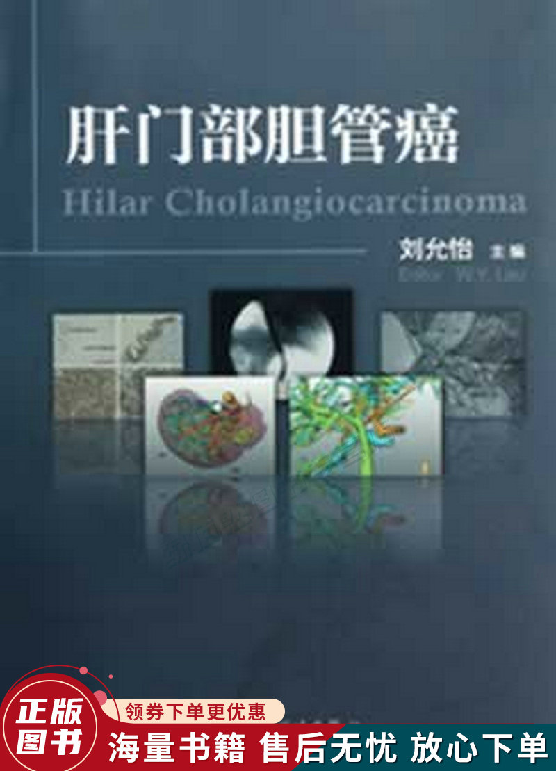 肝门部胆管癌