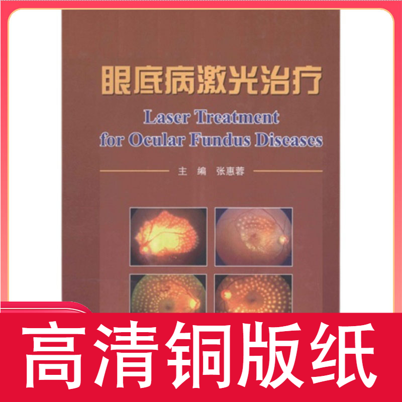眼底病激光治疗 张惠蓉眼第9版 铜版纸