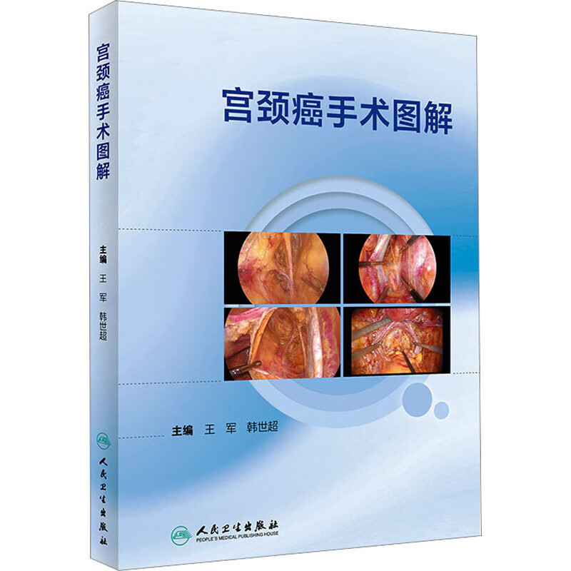宫颈癌手术图解
