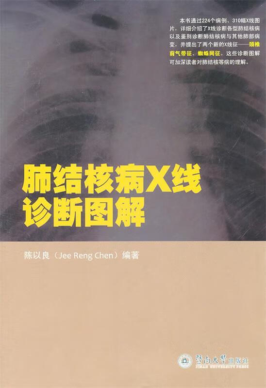 肺结核病X线诊断图解 陈以良 编著