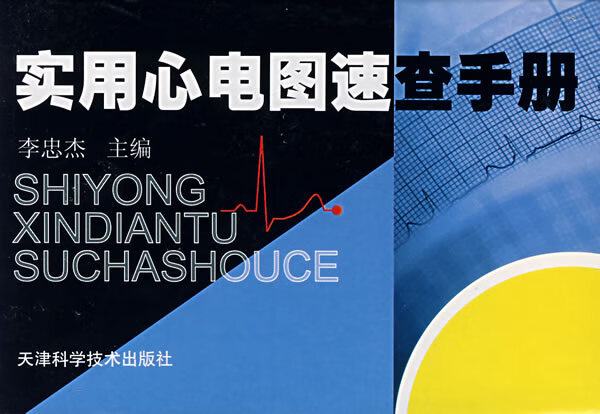 实用心电图速查手册