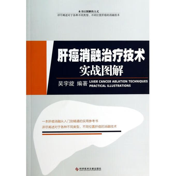 肝癌消融治疗技术实战图解