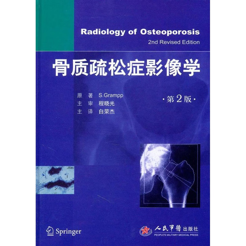骨质疏松症影像学
