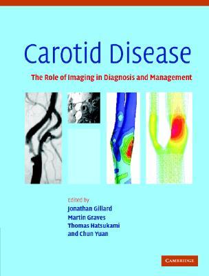 高被引Carotid Disease: The Role of Imaging in Diag