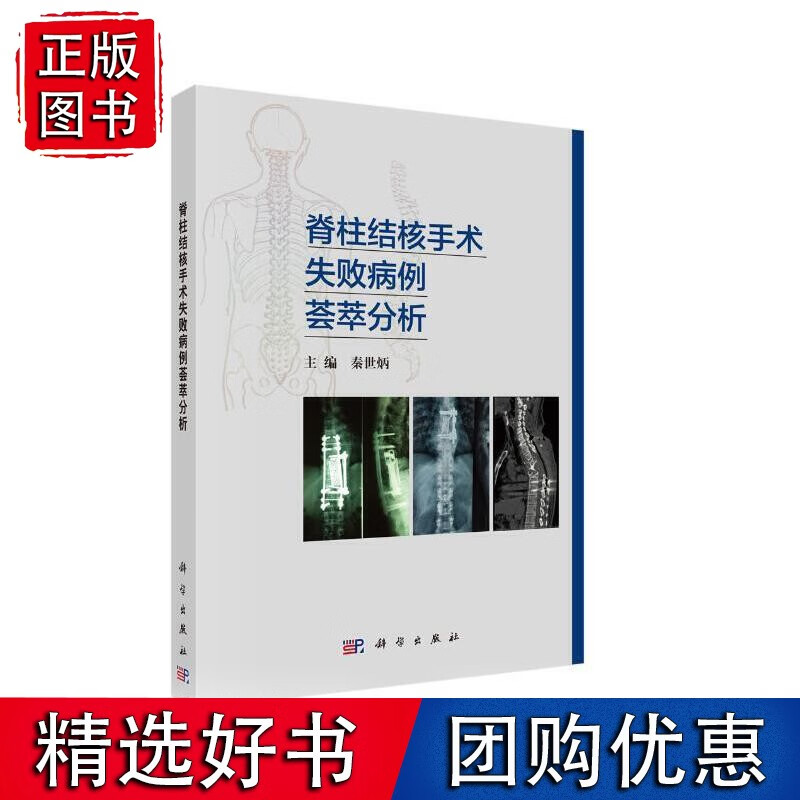 脊柱结核手术失败病例荟萃分析