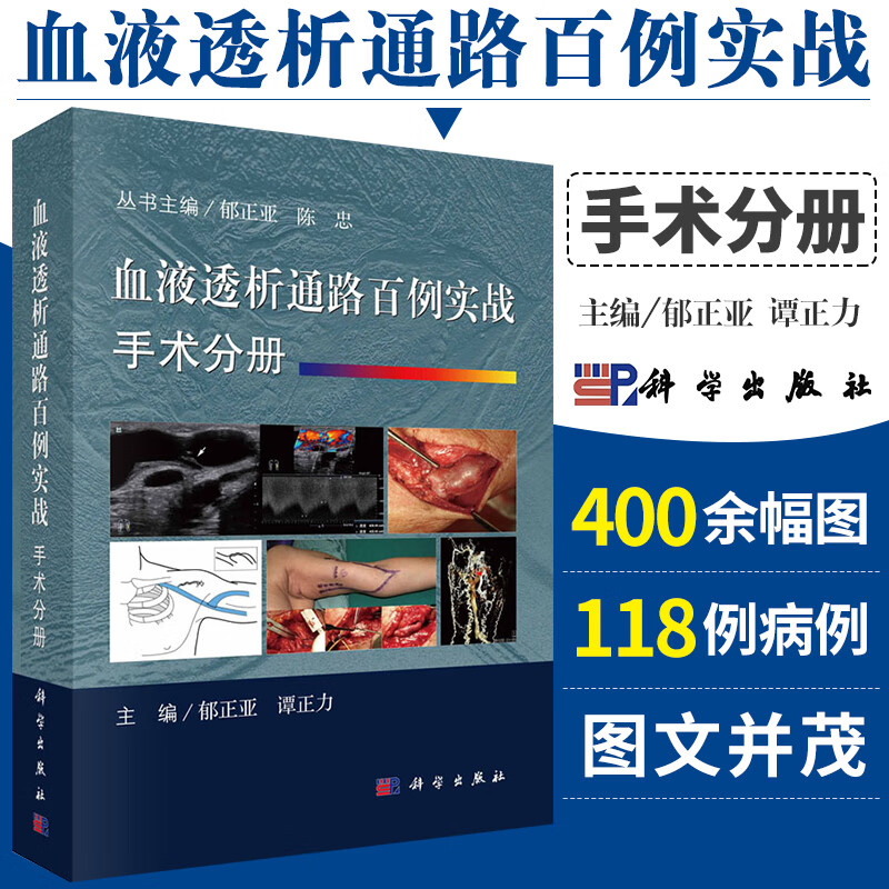 血液透析通路百例实战 手术分册开放手术建立透析通路以及通路并发症的治疗 谭正力主编 血管超声图像血管造影图像 科学出版社