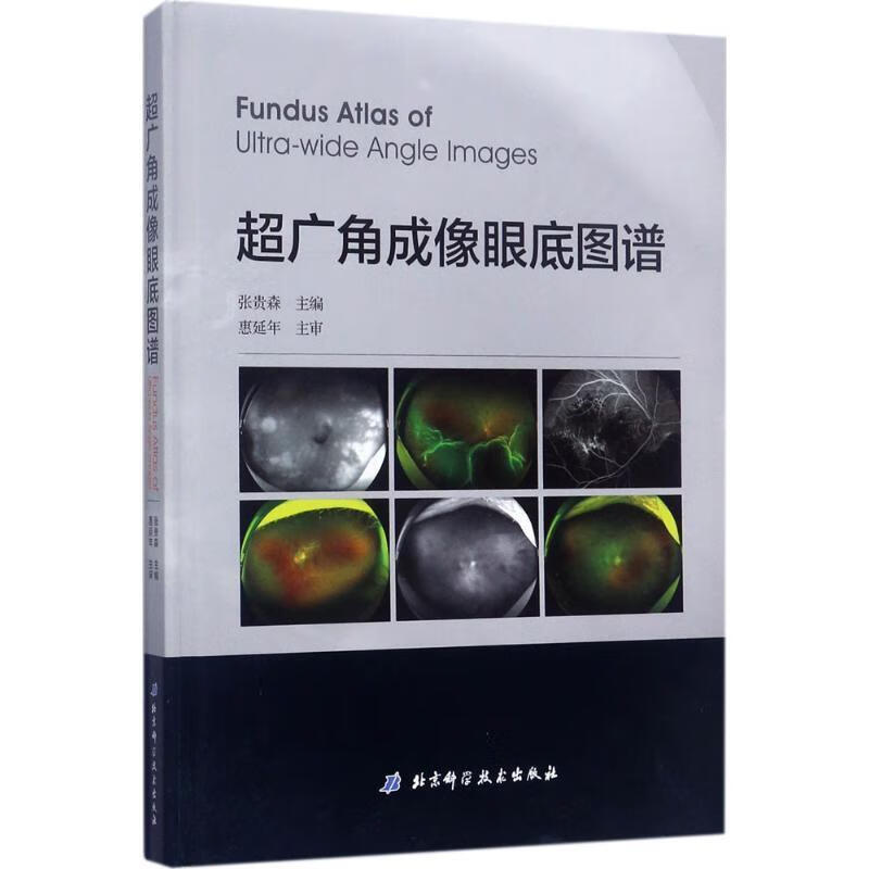 超广角成像眼底图谱 张贵森 著