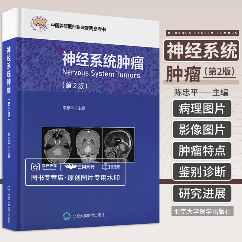 神经系统肿瘤 第2版 中国肿瘤医师临床实践指南丛书 陈忠平 北京大学医学出版社 相关学科临床和基础研究者的工具书 神经内分泌学