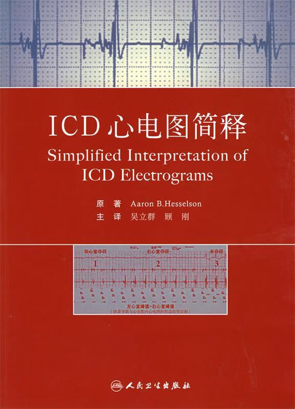 ICD心电图简释