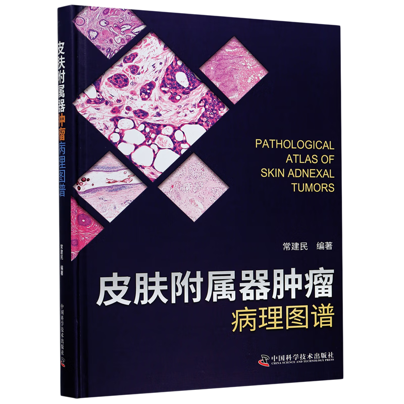 皮肤附属器肿瘤病理图谱(精)