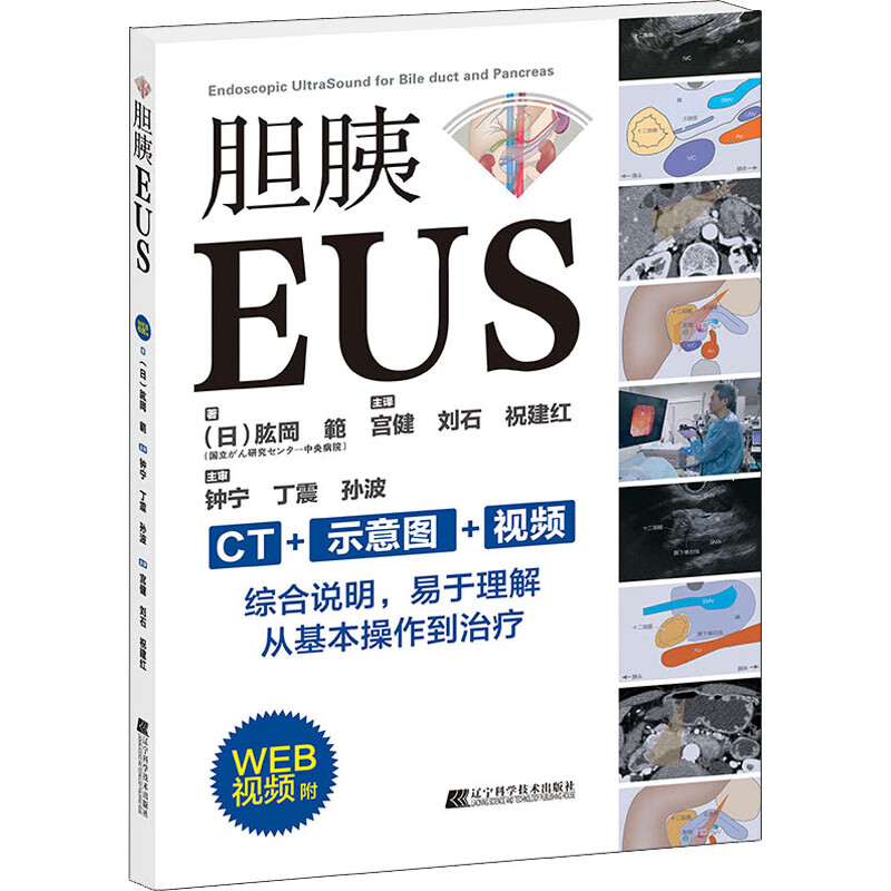 胆胰EUS
