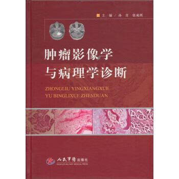肿瘤影像学与病理学诊断
