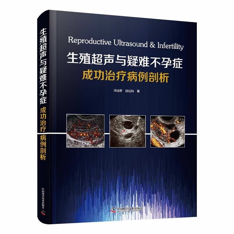 生殖超声与疑难不孕症成功治疗病例剖析
