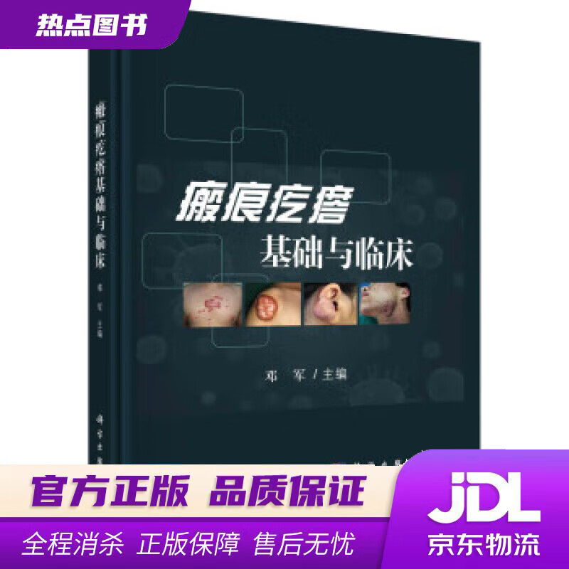 【 官方】瘢痕疙瘩基础与临床 邓军 科学出版社