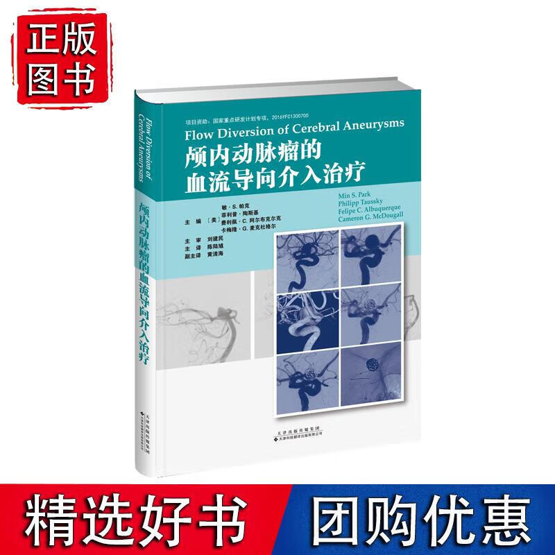 颅内动脉瘤的血流导向介入治疗